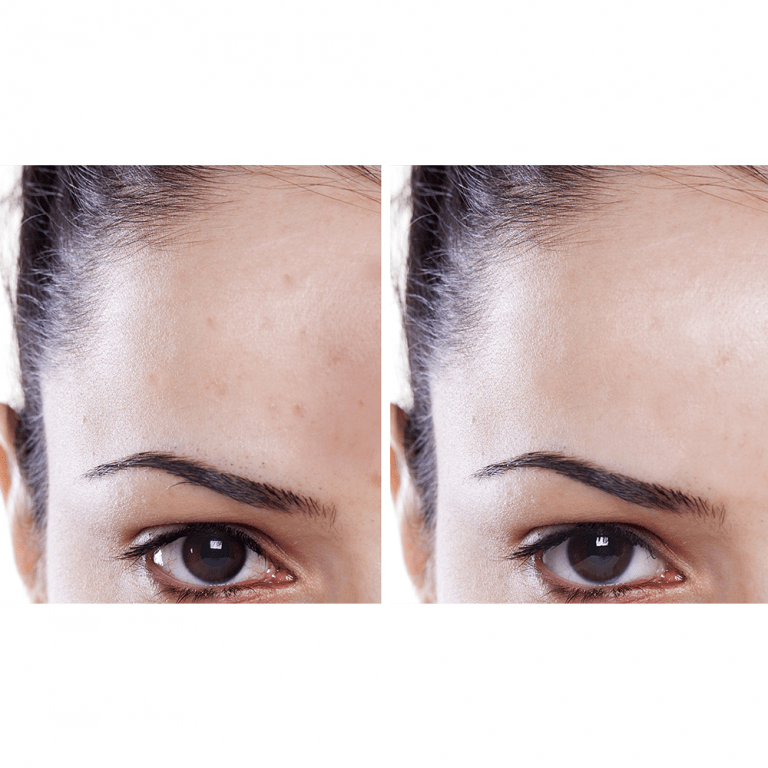 AquaGlo Hydradermabrasion System | Comfortel